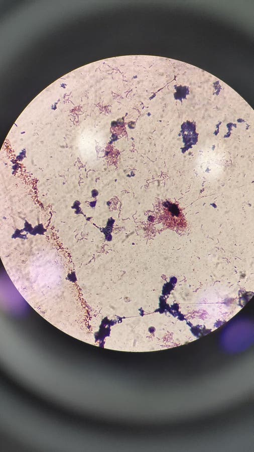 Stained Bacteria Seen through a Microscope Stock Image - Image of ...