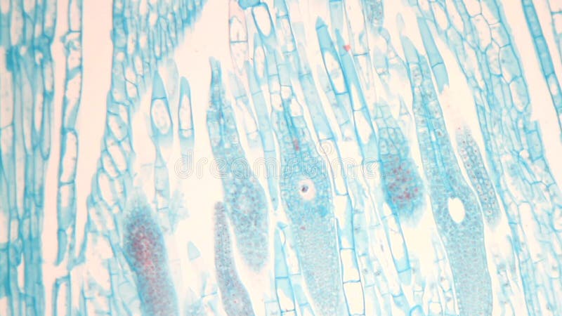 A stained slide of moss stock footage. Video of archegonium - 237521396