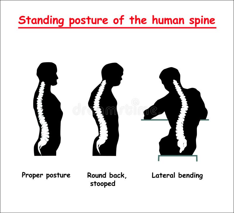 Correct Alignment Of Human Body In Standing Posture For Good ...