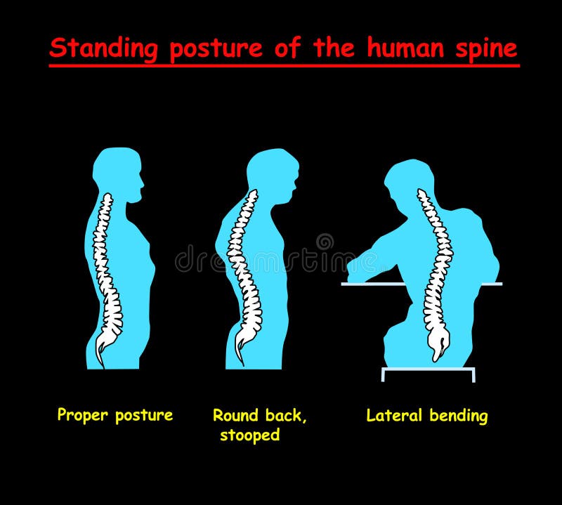 Correct Alignment of Human Body in Standing Posture for Good ...