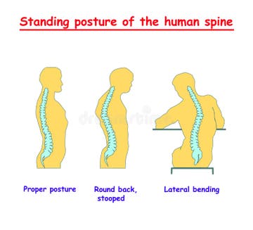 Posture Defects Stock Illustrations – 21 Posture Defects Stock ...