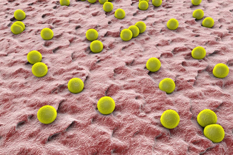 Staphylococci on the Surface of Skin Stock Illustration - Illustration ...