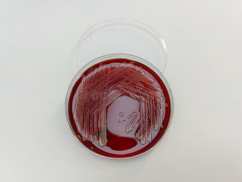 Staphylococcus Aureus Bacteria Displayed on Blood Agar Plate on a White ...
