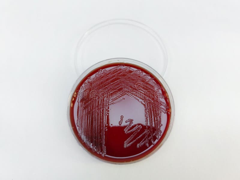 Staphylococcus Aureus Bacteria Displayed on a Blood Agar Plate on White ...