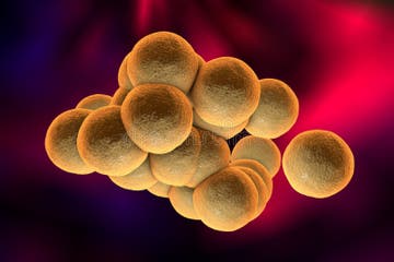 Staphylococcus Aureus Sepsis Stock Illustrations – 242 Staphylococcus ...