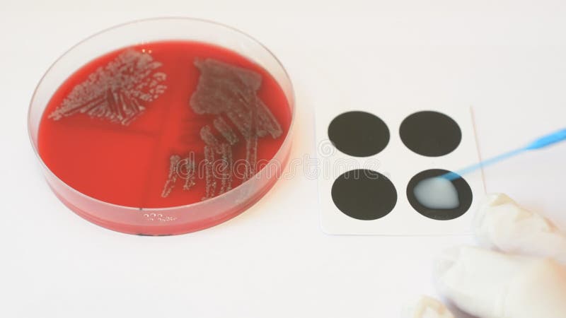 Staphylococcus Aureus Bacteria from Nasal Exudate Stock Video - Video ...