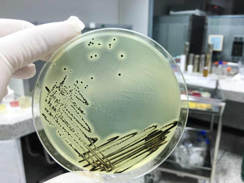 Staphylococcus Aureus Grow on Baird Parker Agar. Stock Photo - Image of ...