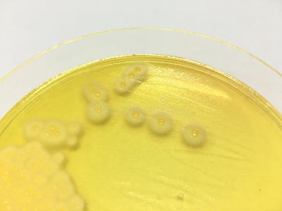 Staphylococcus Aureus Grow on Mannitol Salt Agar. Stock Image - Image ...