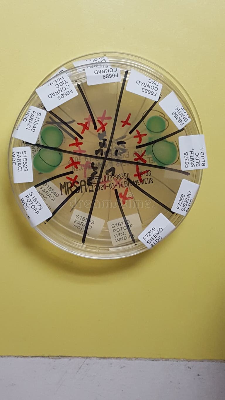 Patient Aureus Staphylococcus Stock Photos - Free & Royalty-Free Stock ...