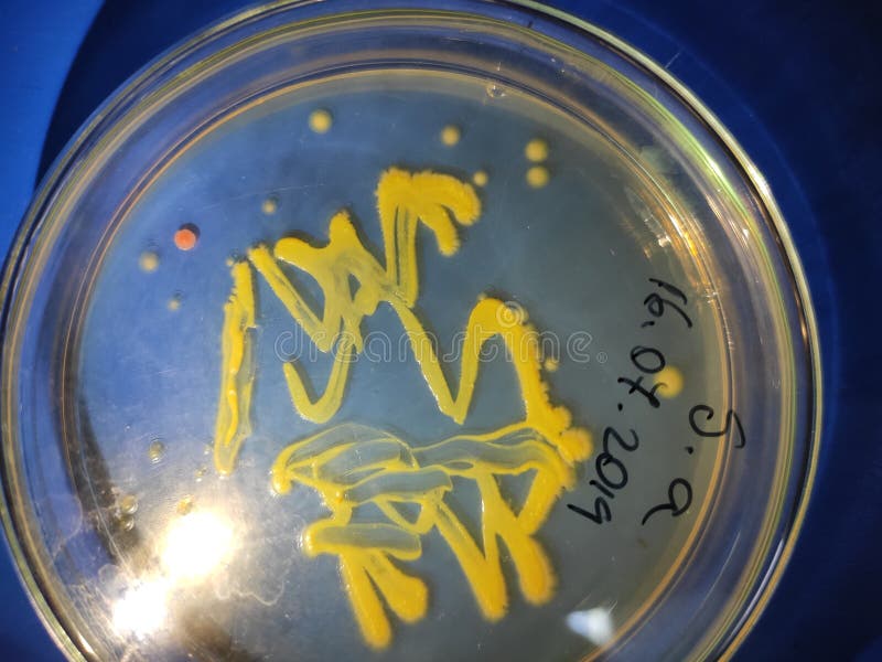 A Culture of Staphylococcus Aureus Bacteria Stock Photo - Image of ...