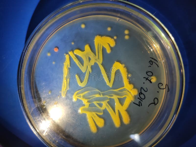 A Culture of Staphylococcus Aureus Bacteria Stock Photo - Image of ...