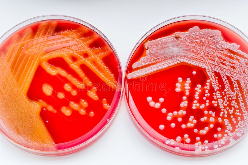 Staphylococcus Aureus and Streptococcus Pyogenes Stock Photo - Image of ...
