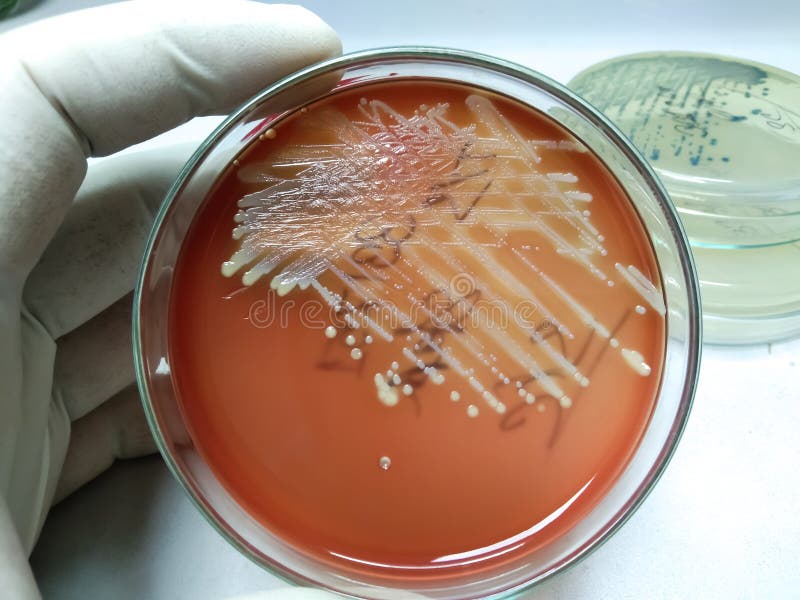 Staphylococcus Growth on Blood Agar. Stock Image - Image of food ...
