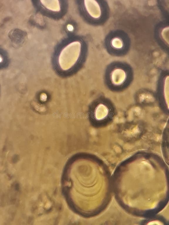 Starch Granules Viewed Under Light Microscope Stock Image - Image of ...