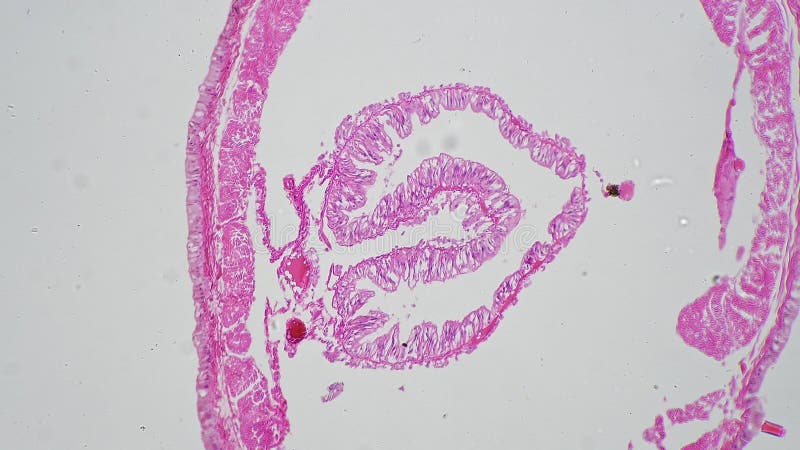 Earthworm Cut in Transversal Section and Magnified in 200 Times Under ...