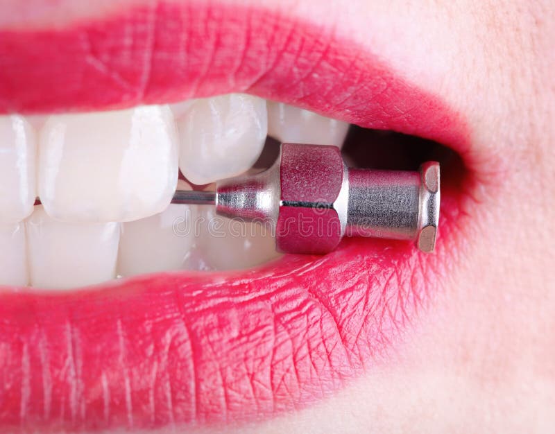 Steel Needle in the Woman S Mouth Stock Image - Image of dental, gums ...