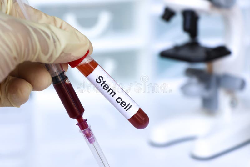 Stem Cell Test To Look for Abnormalities from Blood Stock Image - Image ...