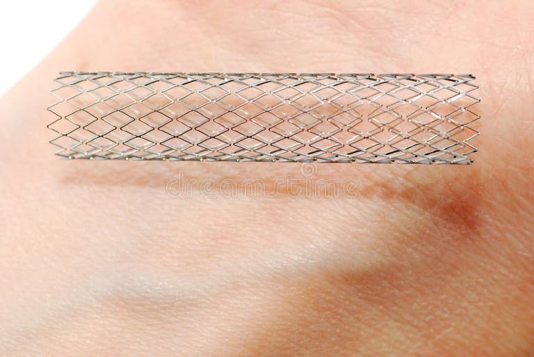 A stent stock photo. Image of protection, atheriosclerosis - 4900048