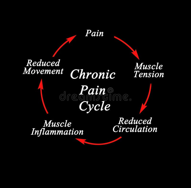 Chronic Pain Cycle stock illustration. Illustration of pain - 239565704