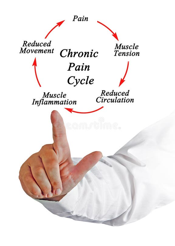 Chronic Pain Cycle stock photo. Image of movement, inflammation - 239565766