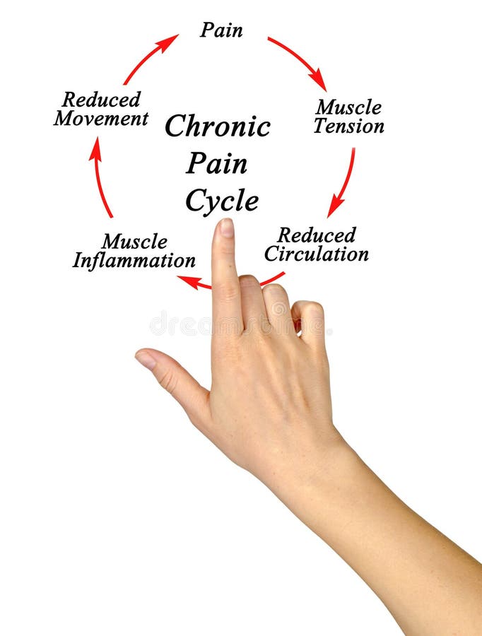 Chronic Pain Cycle stock image. Image of finger, screen - 169534221