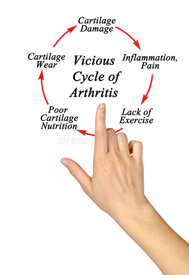 Vicious Cycle of Arthritis stock image. Image of hand - 169534163 Vicious Cycle of Arthritis stock image. Image of hand - 169534163