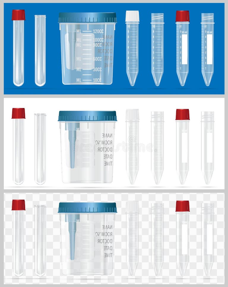 Urine Sample Analysis Stock Illustrations – 623 Urine Sample Analysis ...