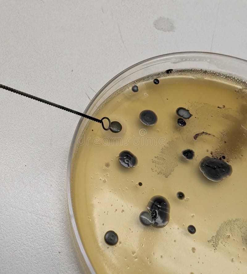 The inoculating loop stock image. Image of biological - 158135695