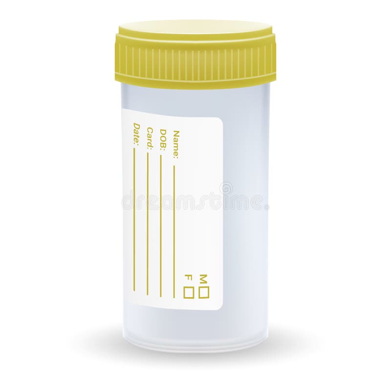 Urine Test Strip with the Plastic Jar of Urine. Medical Examination on ...