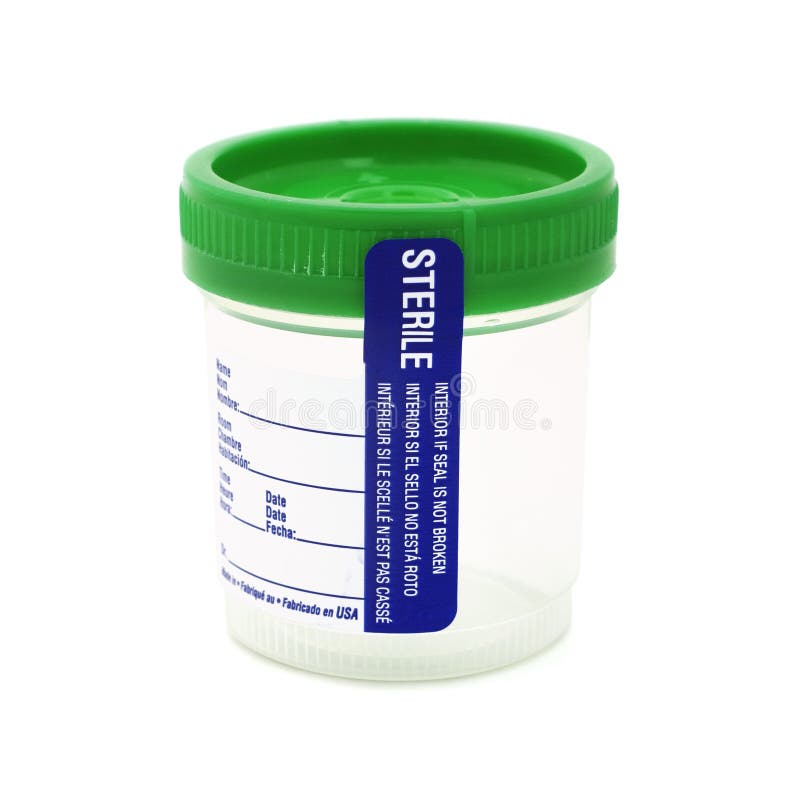 Sterile Urine Cup stock image. Image of diagnose, testing - 76481925