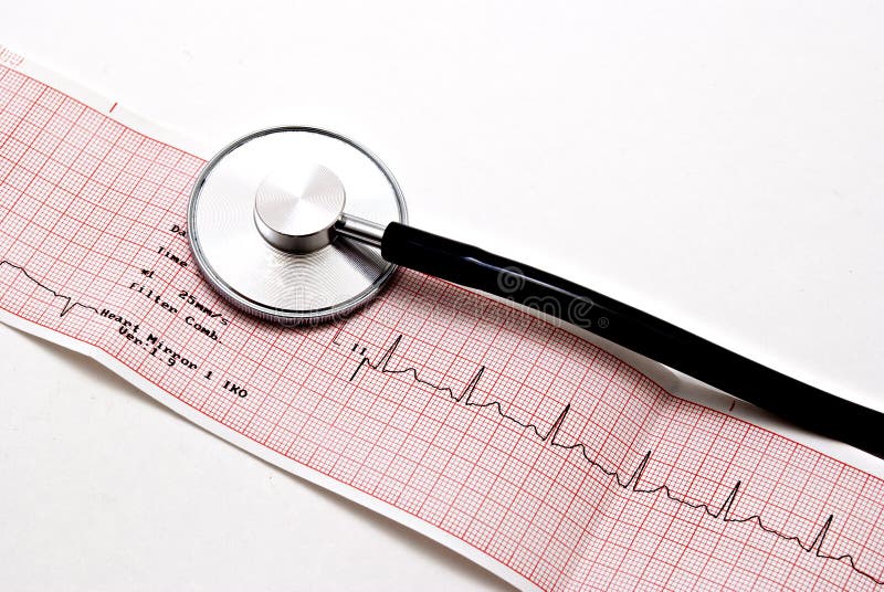 Stethoscope with ECG stock photo. Image of healthy, background - 27711440