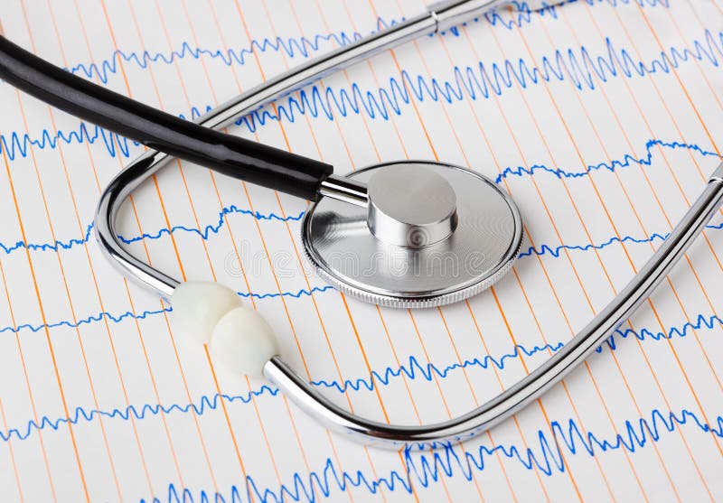 EKG and stethoscope stock photo. Image of graph, signal - 4283988
