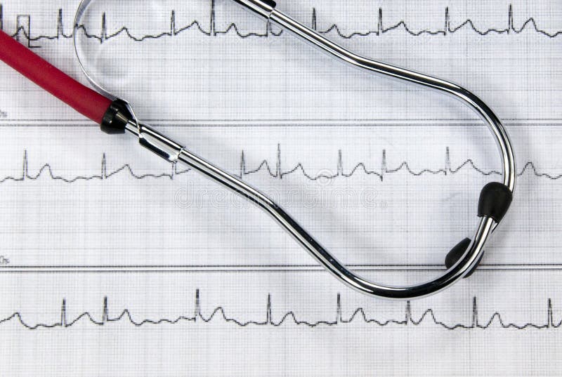 ECG and stethoscope stock image. Image of health, cardiogram - 7664891