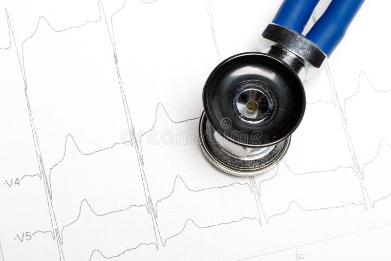 Stethoscope on an Electrocardiogram (ECG) Chart Background Stock Photo ...