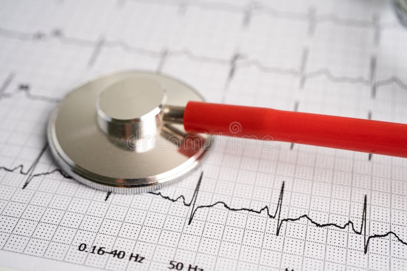 Stethoscope on Electrocardiogram ECG, Heart Wave, Heart Attack ...