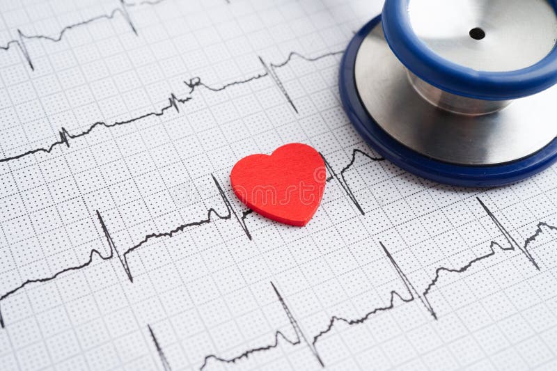 Electrocardiogram (ECG), Heart Wave, Heart Attack, Cardiogram Report ...
