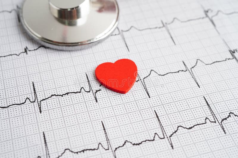 Stethoscope on Electrocardiogram (ECG), Heart Wave, Heart Attack ...