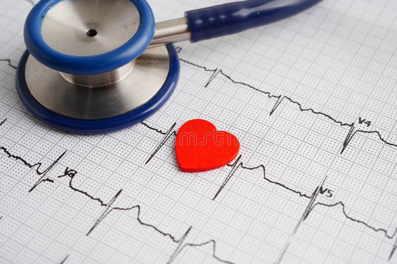 Stethoscope on Electrocardiogram (ECG), Heart Wave, Heart Attack ...