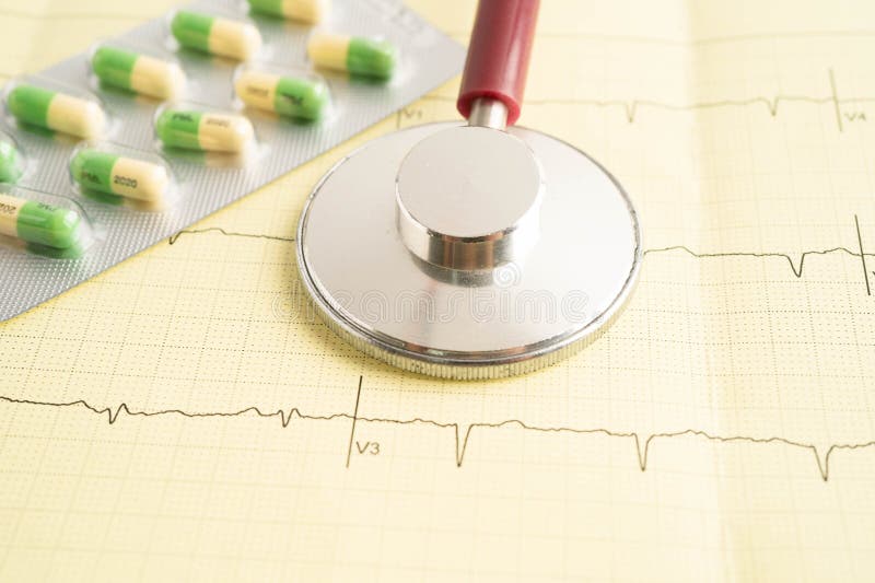 Stethoscope on Electrocardiogram ECG, Heart Wave, Heart Attack ...