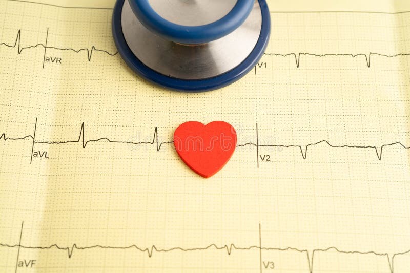 Electrocardiogram (ECG), Heart Wave, Heart Attack, Cardiogram Report ...