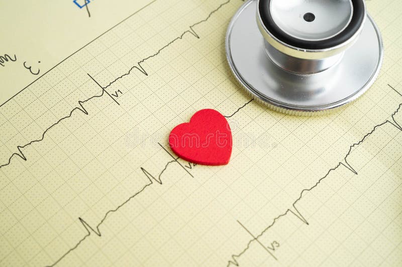 Stethoscope on Electrocardiogram ECG, Heart Wave, Heart Attack ...