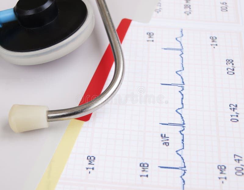 Stethoscope on a Stock Chart - Market Analysis Stock Image - Image of ...