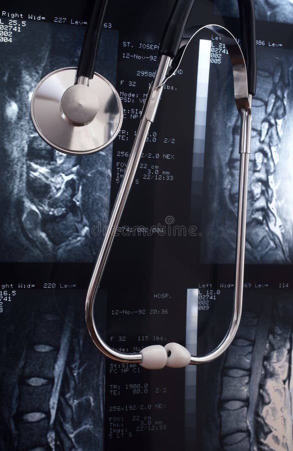 Stethoscope On MRI stock photo. Image of heartbeat, hospital - 4915126