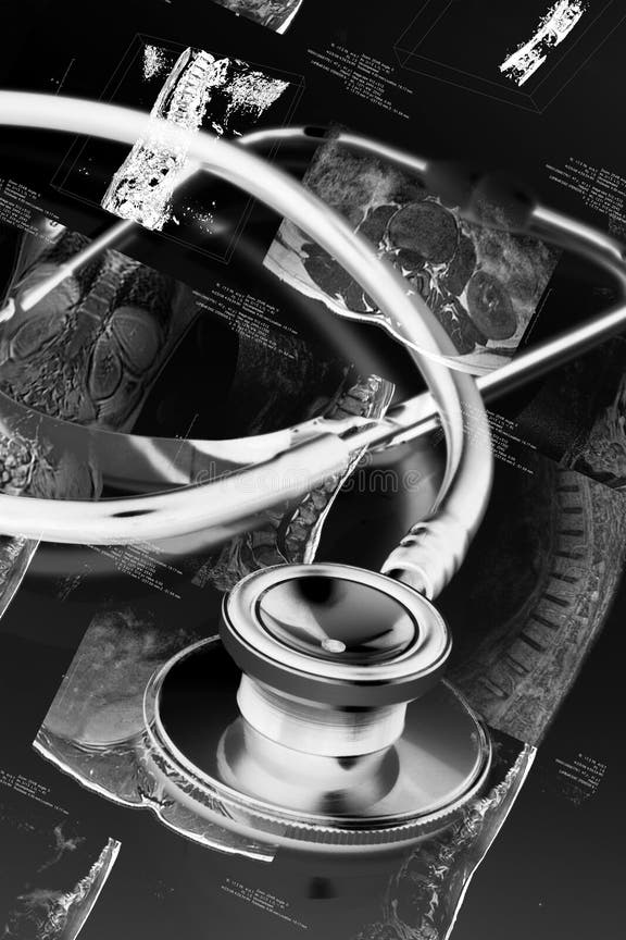 Stethoscope with MRI and Xray Images Stock Photo - Image of human ...