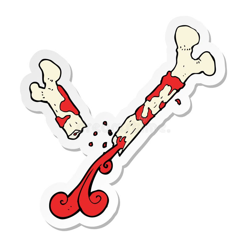 Broken Bone Cartoon Stock Illustrations – 2,573 Broken Bone Cartoon ...