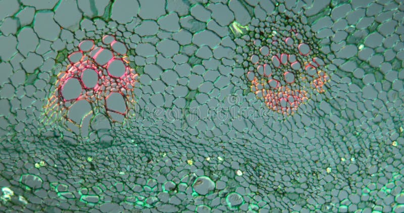 Stinging Nettle Stem Tissue Stock Video - Video of secretion, nettle ...