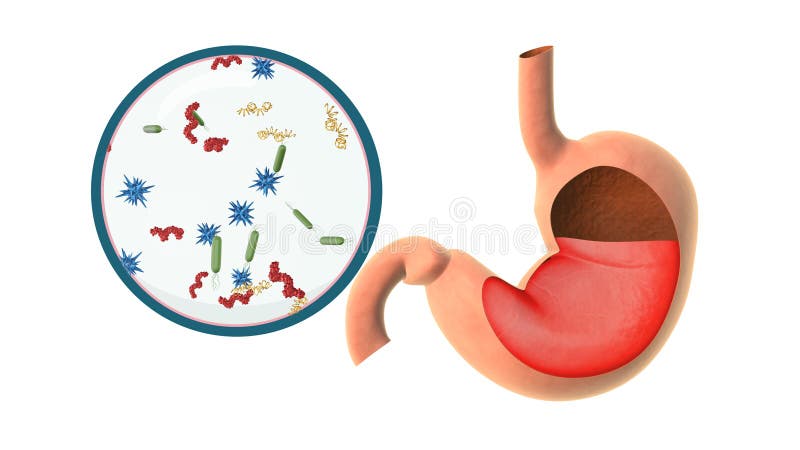 Human Stomach with Viruses and Bacteria Stock Illustration ...