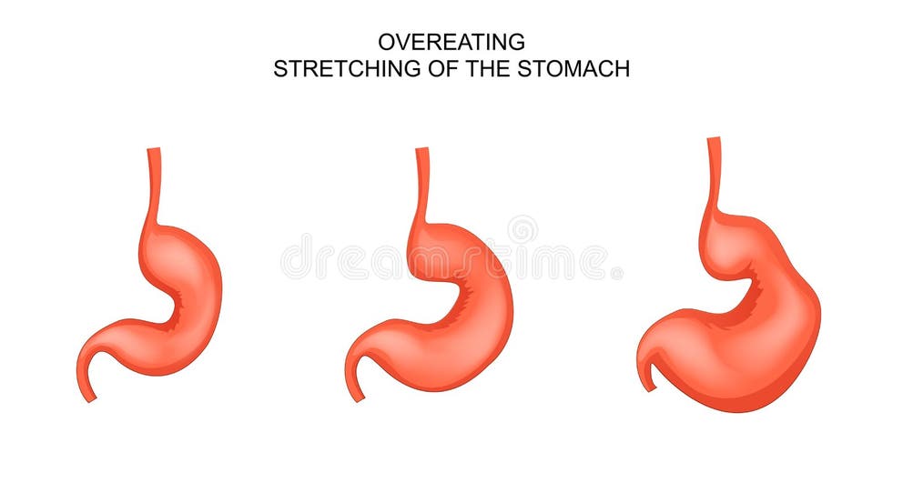 The Stomach,distended from Overeating Stock Vector - Illustration of ...