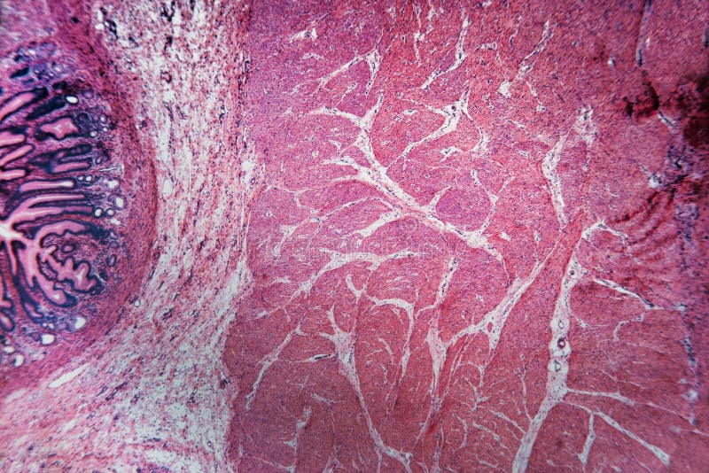 Colonic Stomach Stock Photos - Free & Royalty-Free Stock Photos from ...