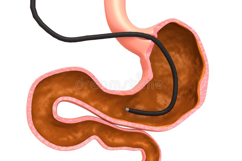 Stomach Endoscopy on Scientific Background Stock Illustration ...